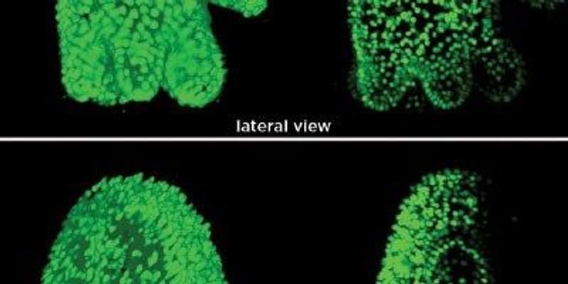 Live Imaging Using Light-Sheet Microscopy | The Scientist