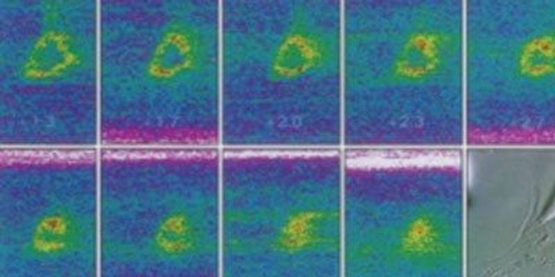 Two-Photon Microscopy’s Historic Influence on Neuroscience | The Scientist