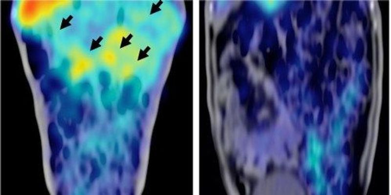 T Cell Traffic Stop Halts SIV | The Scientist