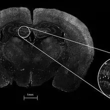 Caliber I.D. Debuts the RS-G4, A New Class of Confocal Microscope | The ...