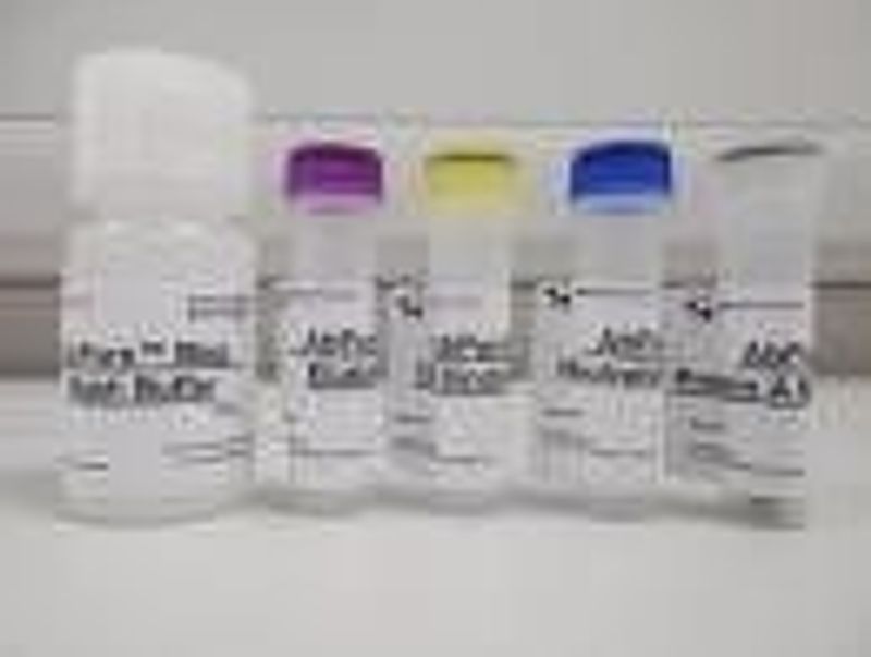 Innova Biosciences Introduces AbPure Magnetic Purification System | The ...