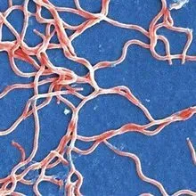 Lyme Disease Cell Shape