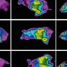 Caloric Restriction Turns White Fat Brown | The Scientist