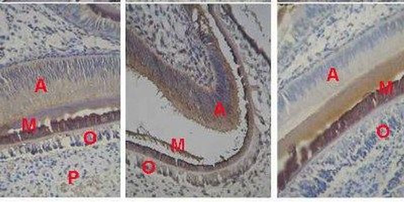 How a Sleep-Associated Hormone Affects Murine Tooth Development | The ...