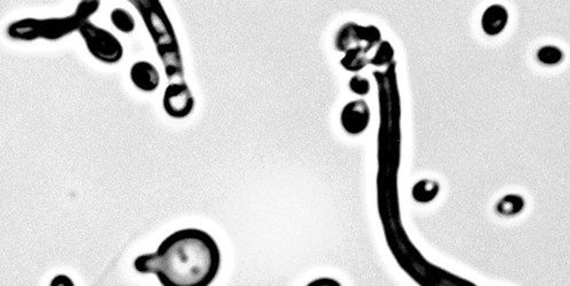 Exploring Alternative Codon Usage in Yeast | The Scientist