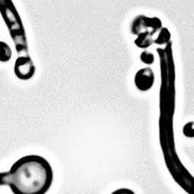 Exploring Alternative Codon Usage in Yeast | The Scientist