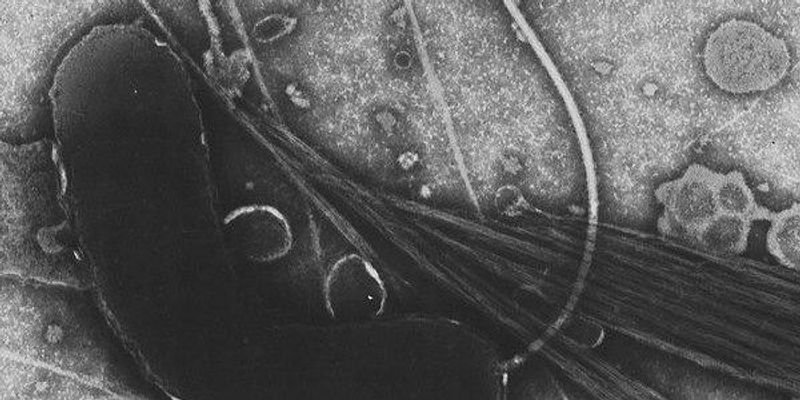 Vibrio Infections On the Rise | The Scientist Magazine®