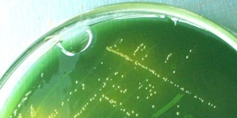 Dethroning E. coli? | The Scientist