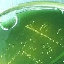 Dethroning E. coli? | The Scientist