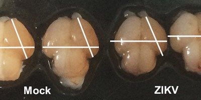 Zika Causes Microcephaly in Mice | The Scientist