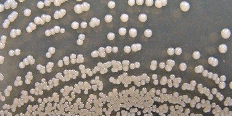 Narrow-Spectrum Antibiotic Could Spare the Microbiome | The Scientist