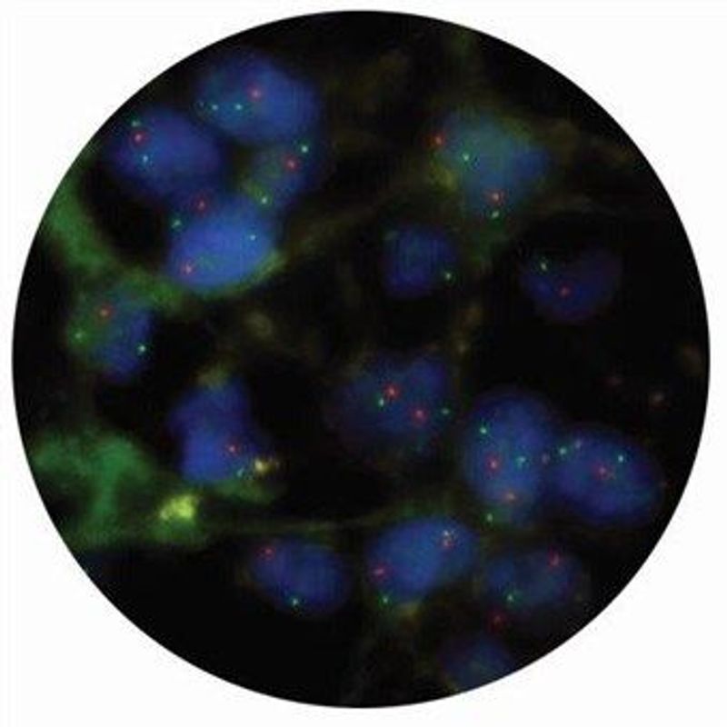 OGT launches Cytocell FISH probes for glial tumours | The Scientist