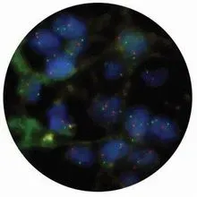 OGT launches Cytocell FISH probes for glial tumours | The Scientist