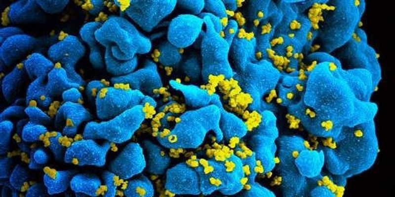 Antibodies Prevent HIV Infection in Monkeys | The Scientist