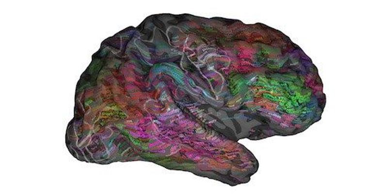 Locating Language within the Brain | The Scientist