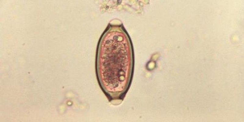 Worm Infection Can Improve Gut Health: Study | The Scientist