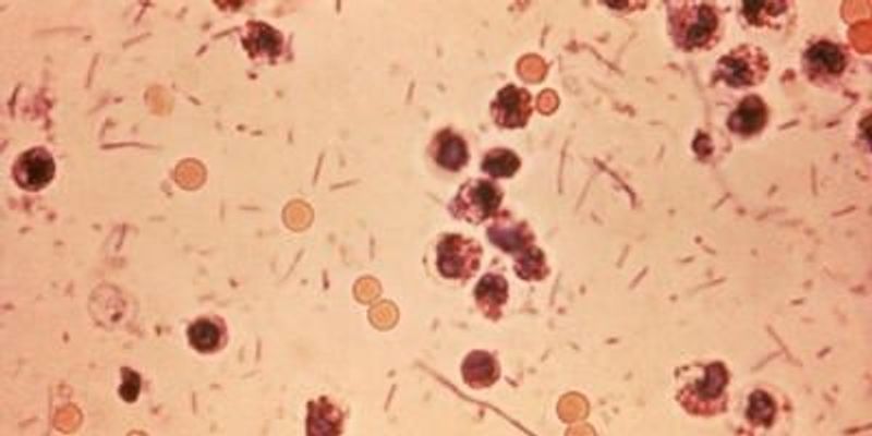 Origins of Dysentery | The Scientist