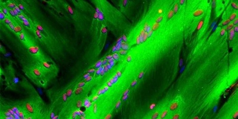Image of the Day: Multicolored Muscles | The Scientist