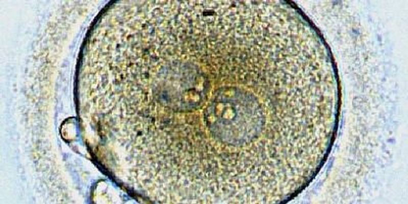 Embryo Editing Gets Green Light in U.K. | The Scientist