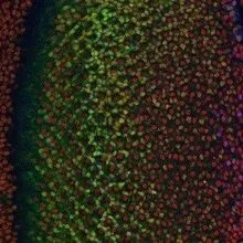 Image of the Day: Seeing Spots | The Scientist