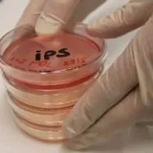 CIRM Ups Translational Velocity | The Scientist