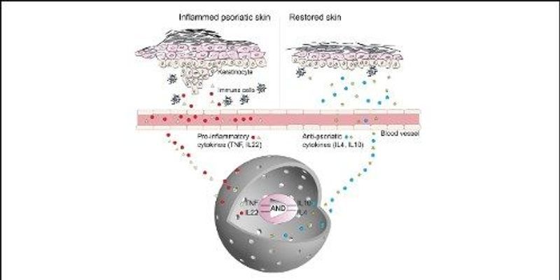 Next Generation: Designer Cells Treat Psoriasis | The Scientist
