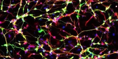 Image of the Day: Distinctive Dopamine | The Scientist