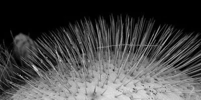 Image of the Day: Fuzzy Vision | The Scientist