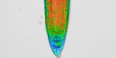 Image of the Day: Calcium Colors | The Scientist