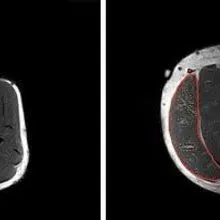 Modelling | The Scientist