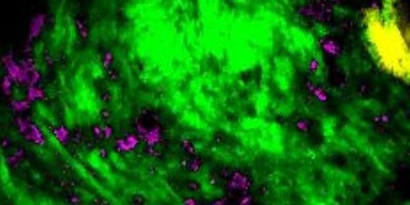 Imaging Live Tissue Without Fluorescence | The Scientist