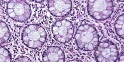 LabQuiz: Tissue Analysis | The Scientist