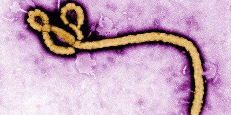 Persistent Virus | The Scientist