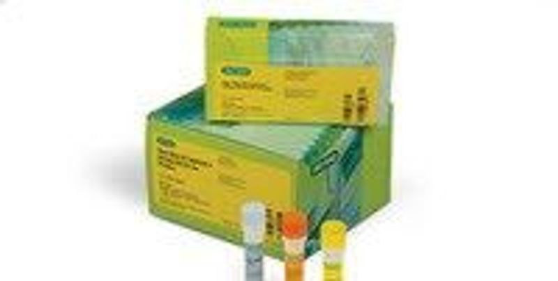 Bio-Rad Launches One-Step RT-ddPCR Advanced Kit for Probes | The Scientist