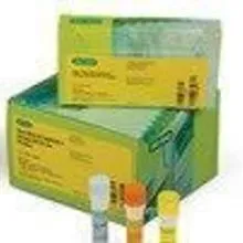 Bio-Rad Launches One-Step RT-ddPCR Advanced Kit for Probes | The Scientist