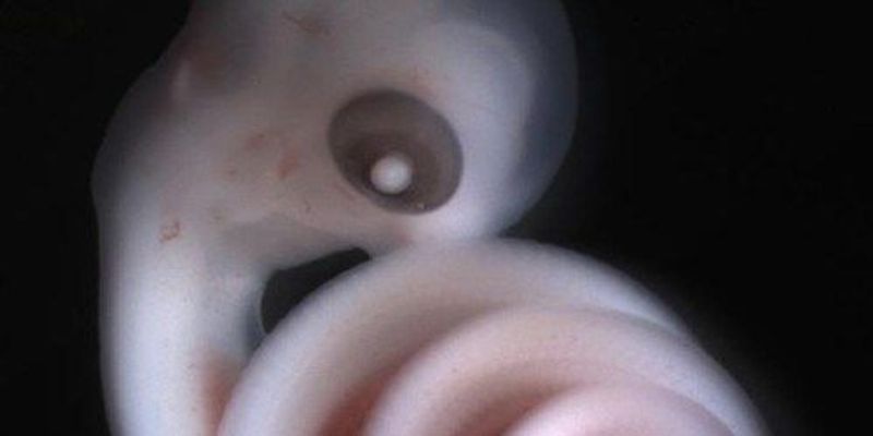 Image of the Day: Snake Embryo | The Scientist
