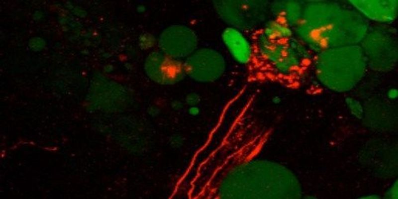 Neuronal Connection Between Fat and the Brain Visualized | The Scientist