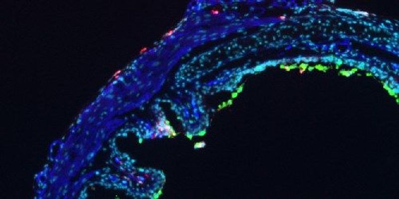 Neutrophils Lead, T Cells Follow | The Scientist