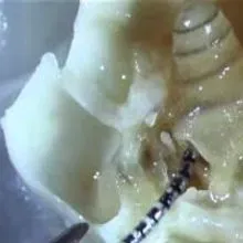 The Bionic Ear | The Scientist