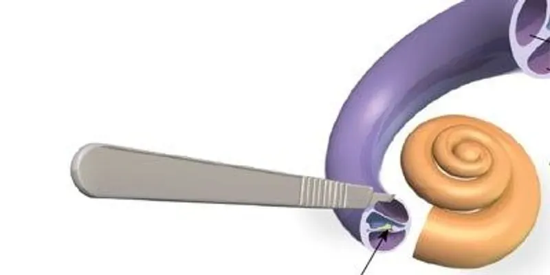 Organ Of Corti | The Scientist