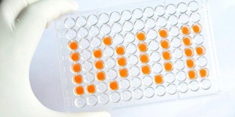 LabQuiz: ELISA | The Scientist