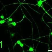 Chemical Cocktails Produce Neurons | The Scientist