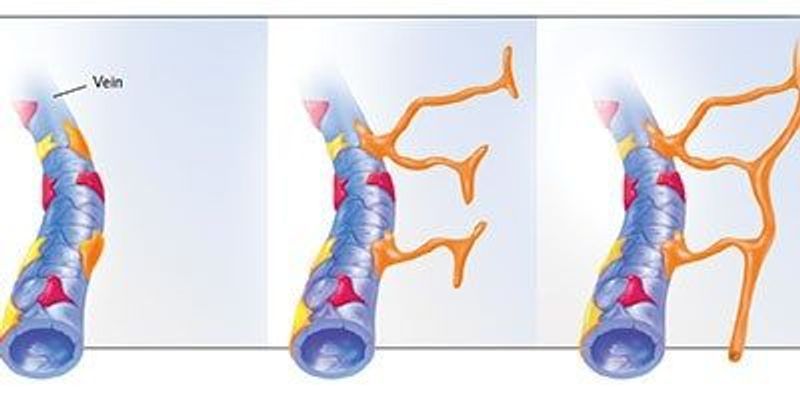 Rethinking Lymphatic Development | The Scientist