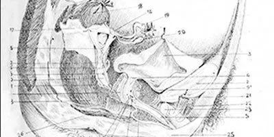 A Case of Sexual Ambiguity, 1865 | The Scientist