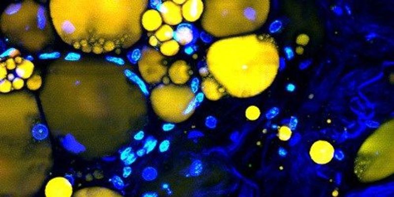 Image of the Day: Lipid Lasers | The Scientist Magazine®