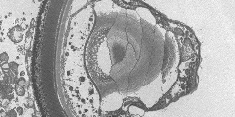 Image of the Day: Ocular Ocelloid | The Scientist Magazine®