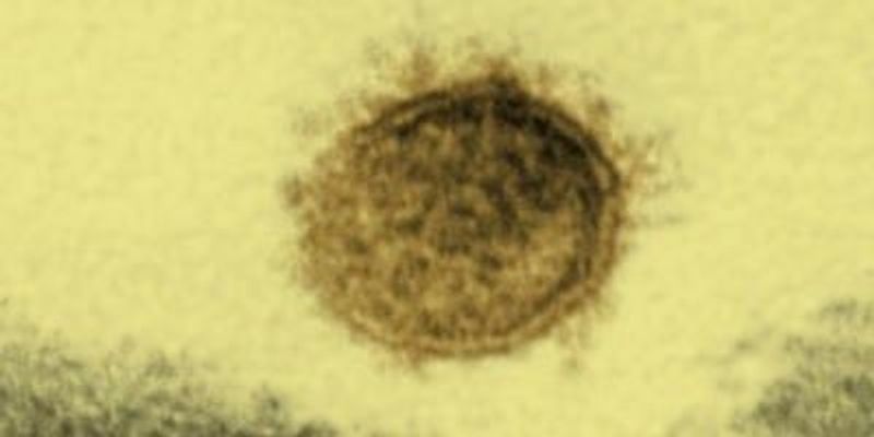 Novel Hantavirus Infection Method | The Scientist