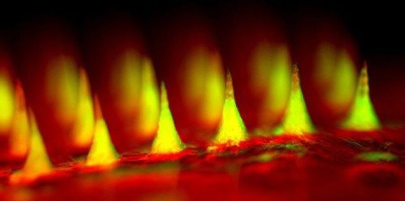 Next Generation: Smart Insulin Patch | The Scientist