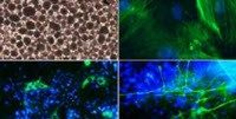 Lonza Introduces New L7™ PBMC Reprogramming Bundle | The Scientist