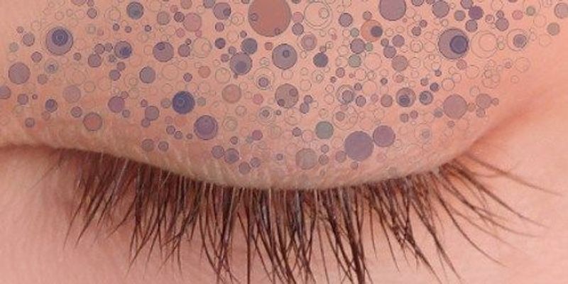 Cancer-Driving Mutations Common in Normal Skin Cells | The Scientist